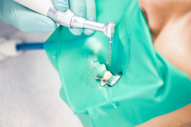 Root Canal Treatments in Lower Parel: Everything You Need to Know ...